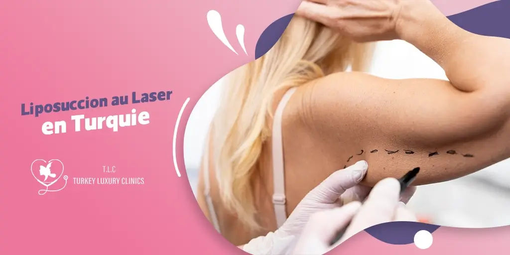 Liposuccion Laser en Turquie Liposuccion Laser en Turquie