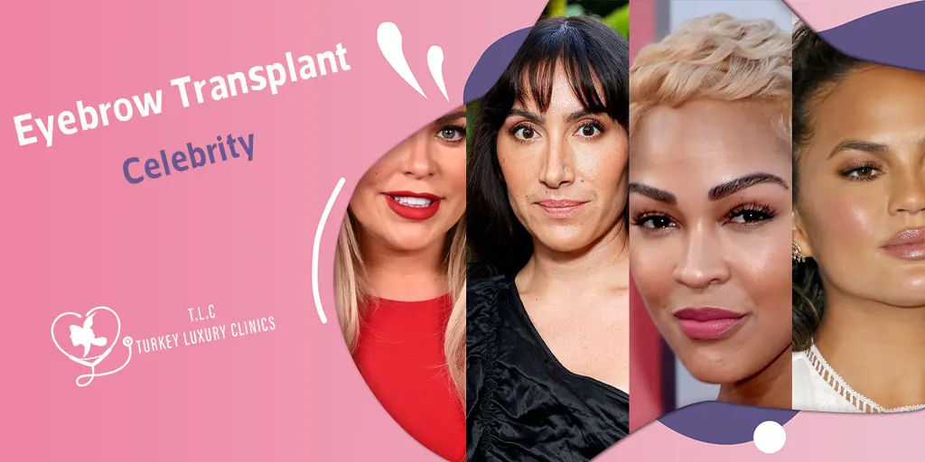 Eyebrow Transplant Celebrity: Fuller Brows of Chrissy Teigen, Meagan ...