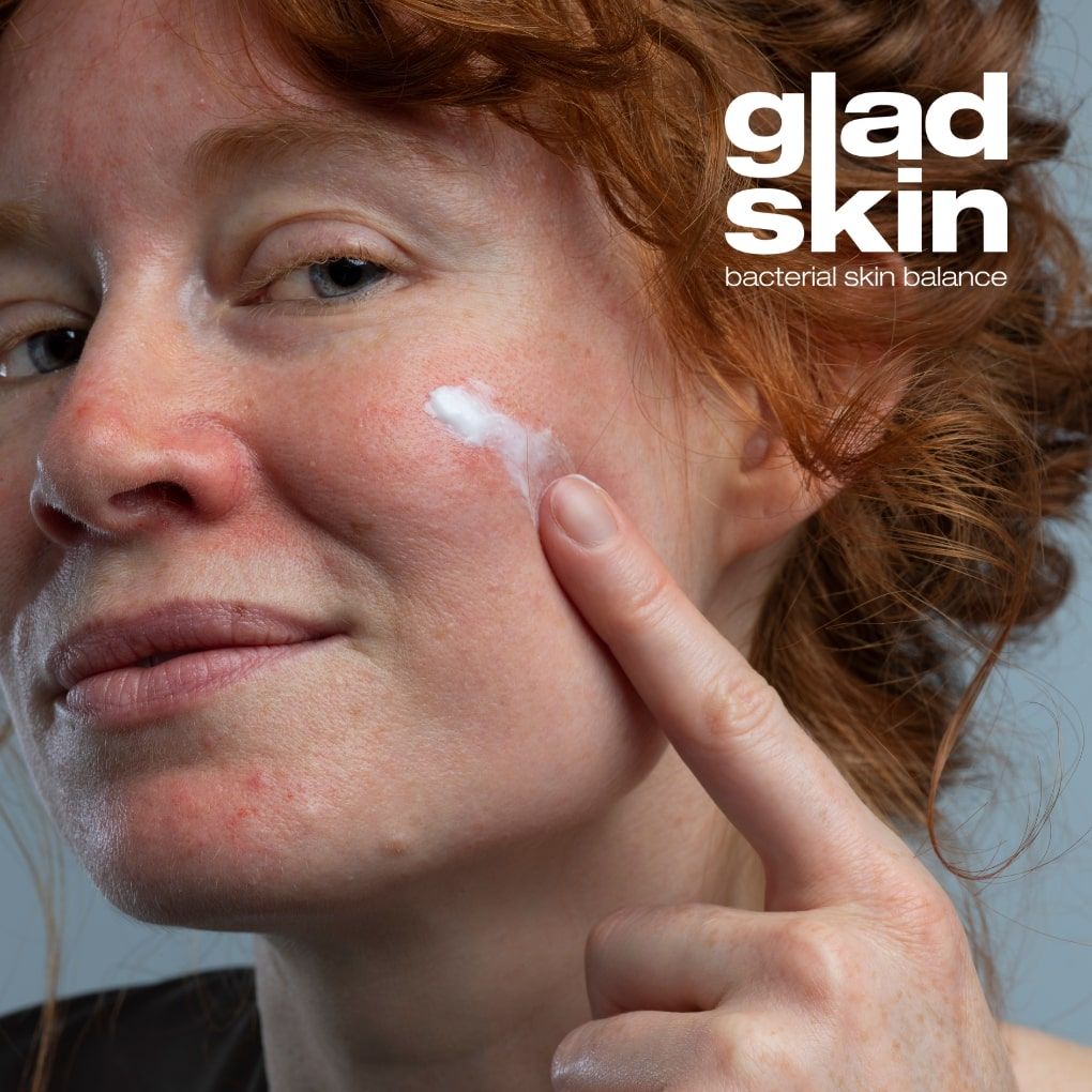 Gladskin Rosacear Cream (15 ml). | eFarma Apotheek En Drogist