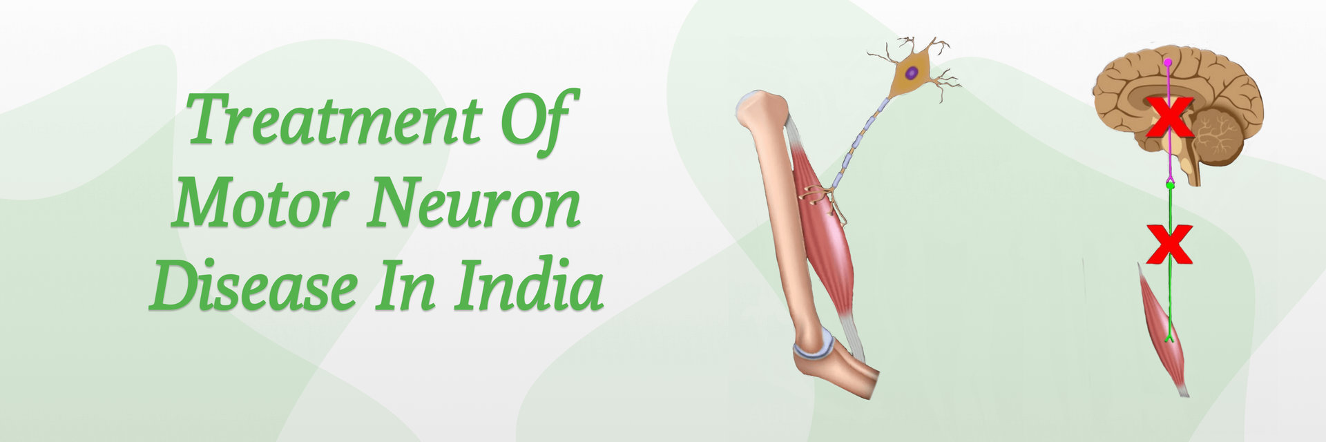 Motor Neuron Disease Treatment In India Know The Best Doctors