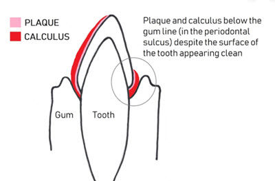 Plaque and Calculus Buildup on Dog Teeth - Dog Friendly Businesses