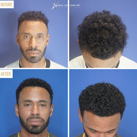 Beverly Hills Institute of Plastic Surgery - Find Cosmetic Surgeons ...