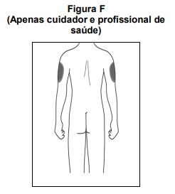 Kesimpta (Ofatumumabe) 20mg/0,4ml - Bula do paciente | Farmaindex