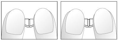 Bula Neblock 5mg - Farmaindex