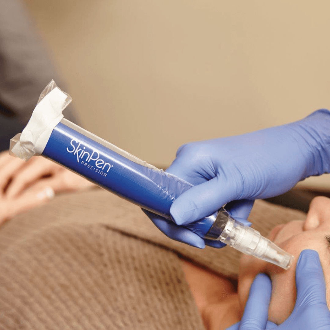 SkinPen® Microneedling | Treatment | Galway Skin Clinic