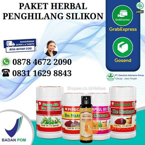 Macam Obat Untuk Membuang Sisa Cairan Suntikan Filler, Wajah, Dagu ...