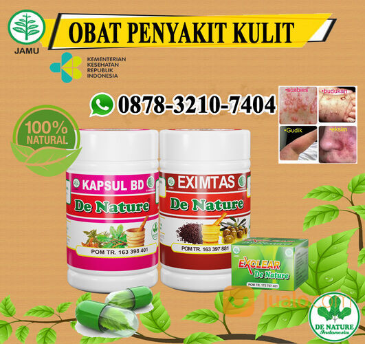Obat Atasi Eksim Kering - Obat Eksim Basah - Obat Gatal Eksim Di Tubuh ...
