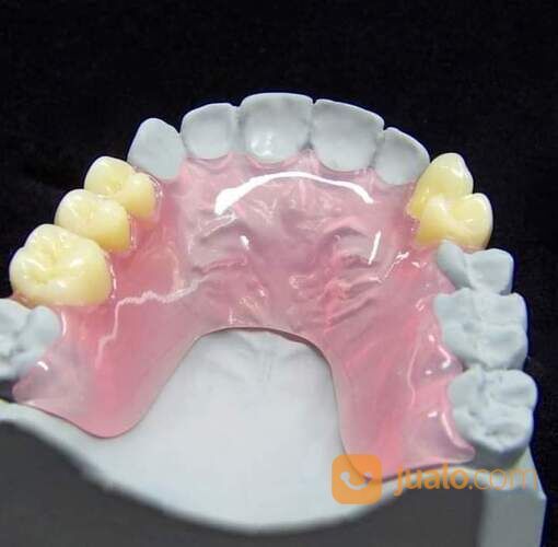 Valplast Gigi Palsu Lentur di Kota Denpasar, Bali | Jualo.com