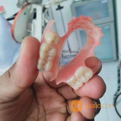 Valplast Gigi Palsu Lentur di Kota Denpasar, Bali | Jualo.com