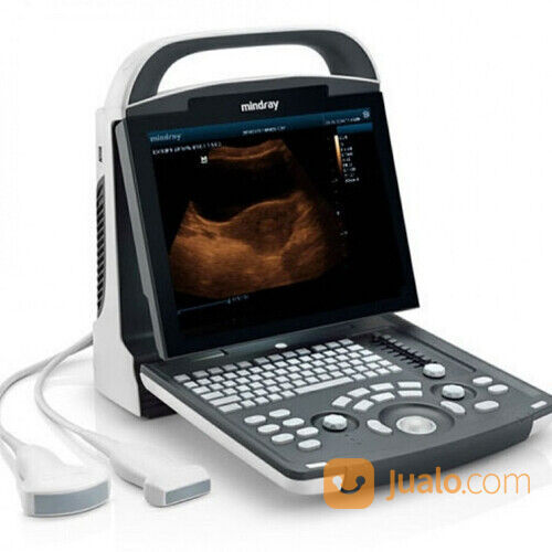 Alat USG Ultrasound Portable Mindray 2D BW Doppler tipe DP10 Power di ...