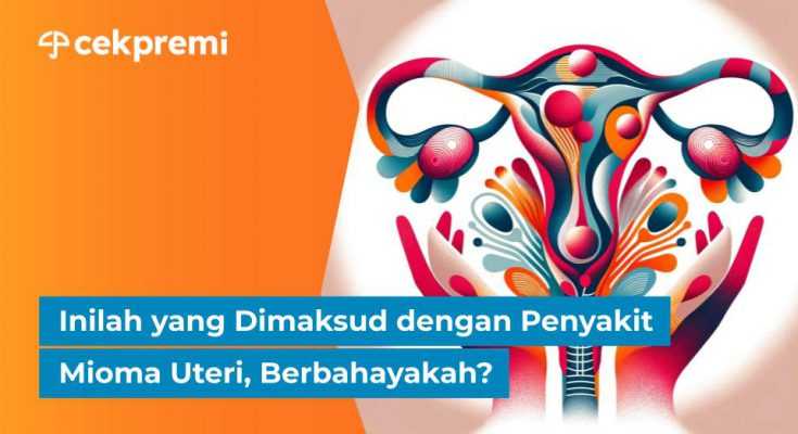 Inilah yang Dimaksud dengan Penyakit Mioma Uteri, Berbahayakah?