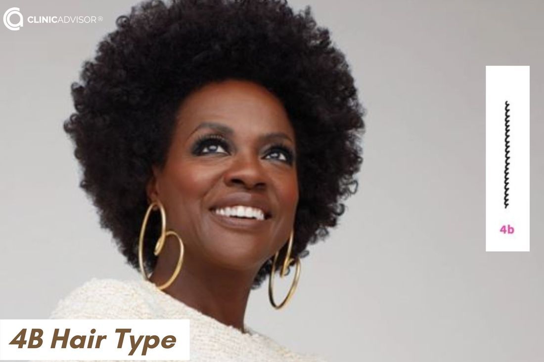 Afro Hair Types Explained: 4a, 4b, and 4c | ClinicAdvisor®