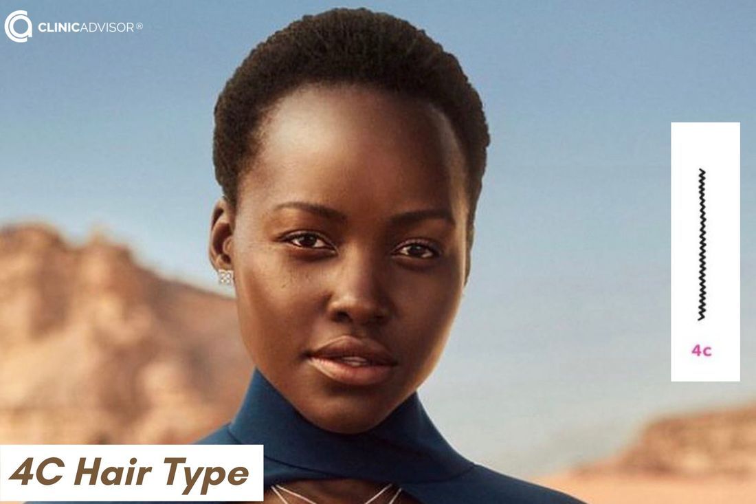 Afro Hair Types Explained: 4a, 4b, and 4c | ClinicAdvisor®