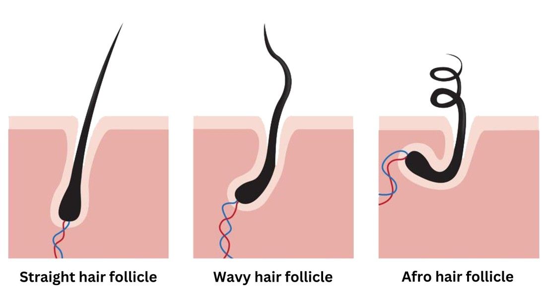 Afro Hair Types Explained: 4a, 4b, and 4c | ClinicAdvisor®