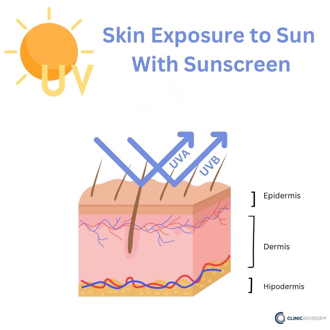 20 Health Benefits of Using Sunscreen: Dermatological, Preventive, and ...