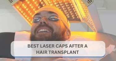 5 Best Laser Caps for Hair Loss: Top Picks for 2025