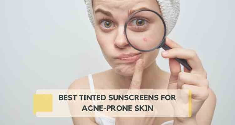 Best Tinted Sunscreens for Acne-Prone Skin (2025) – Reviews & Buying Guide