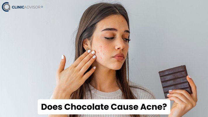 Is Chocolate Bad for Skin? Does It Cause Acne?
