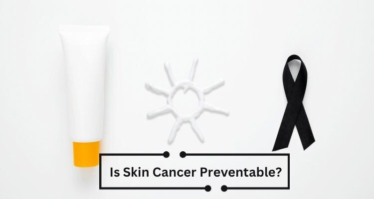 How to Prevent Skin Cancer: Essential Tips for Sun Safety