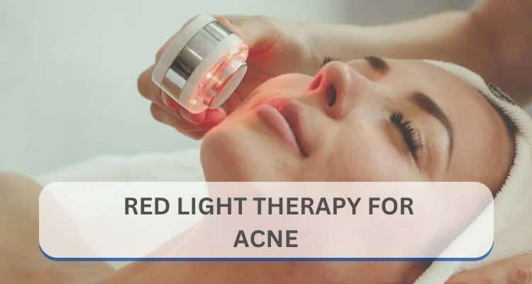 Red Light Therapy for Acne: A Comprehensive Guide to Clearer Skin
