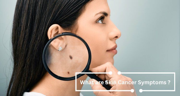 Skin Cancer Symptoms - ClinicAdvisor