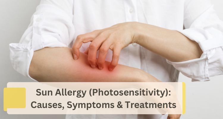 un Allergies (Photosensitivity): Types, Symptoms, Treatment and ...
