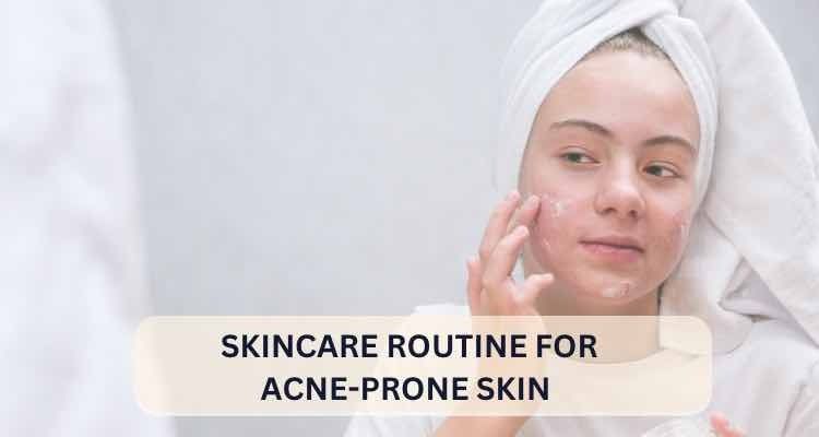 The Ultimate Skincare Routine for Acne-Prone Skin