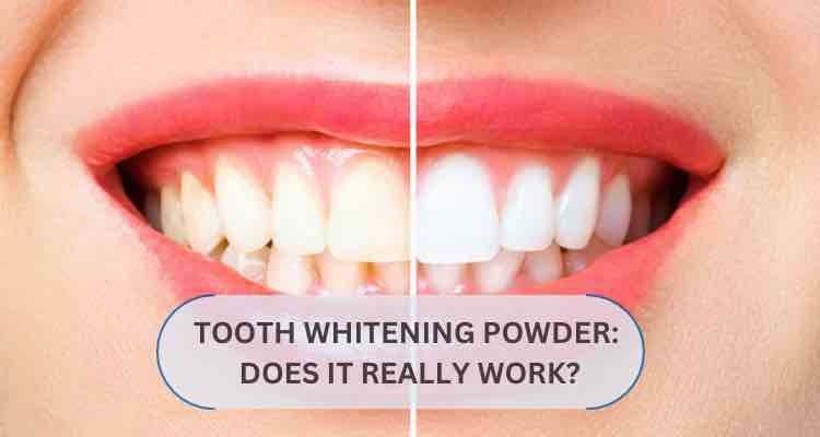 Tooth Whitening Powder: Does It Really Work?