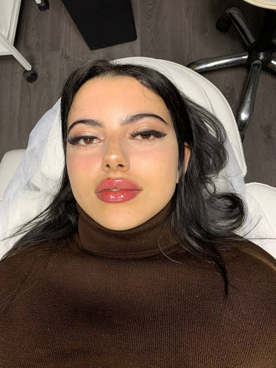 Russian lip and modeling technique in Saghar specialized clinic ...