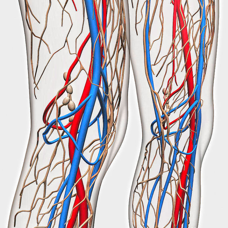Sistemas venosos - o que você precisa saber antes da consulta?