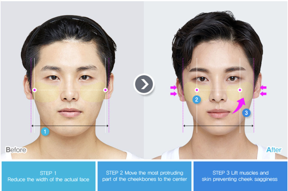 Rhinoplasty & Facial Plastic Surgery - Abdullah Yahya