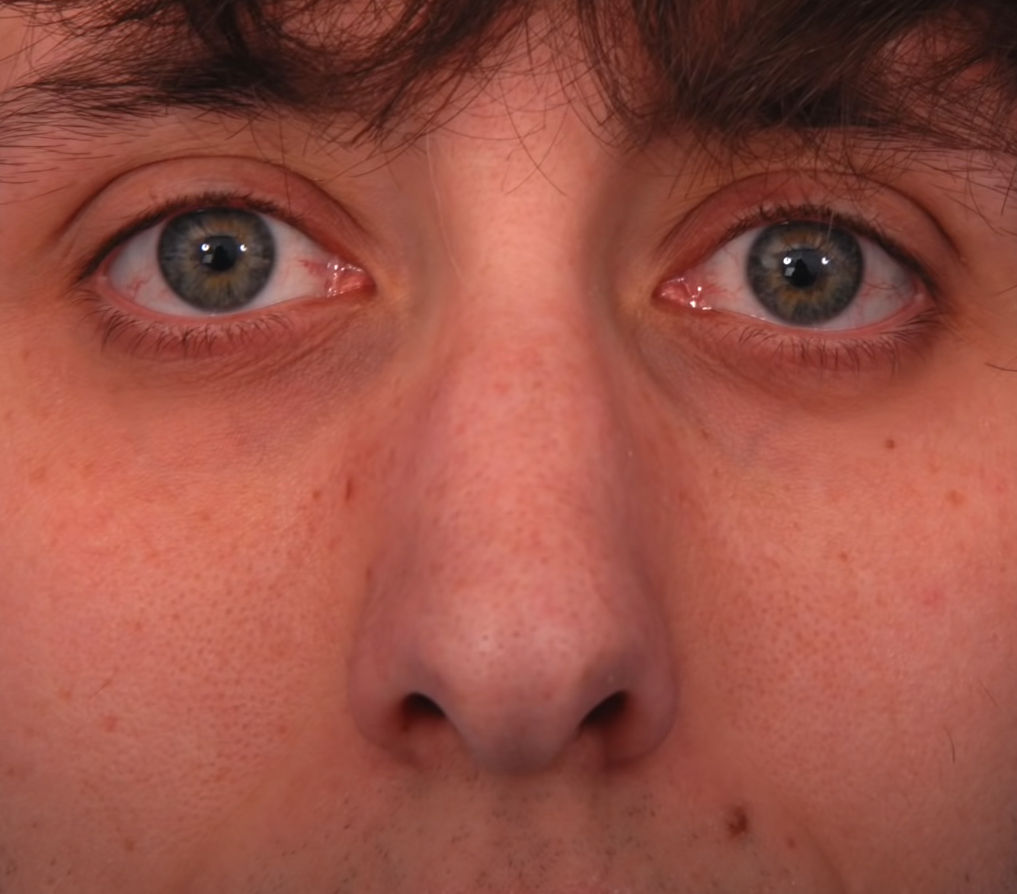 Rhinoplasty & Facial Plastic Surgery - Abdullah Yahya