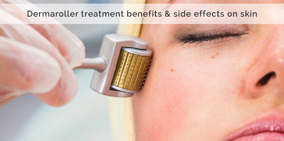 Derma Roller Treatment Benefits & Side Effects On Skin | Euromed® Clinic