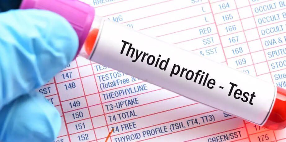 Thyroflex & Thyroid Function Test in Dubai | Euromed® Clinic