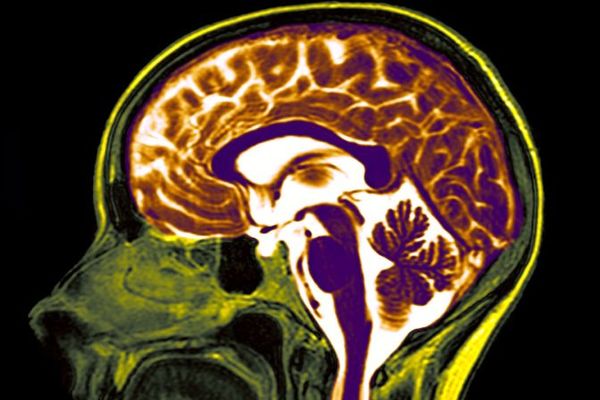 The Fascinating World of Brain Implants