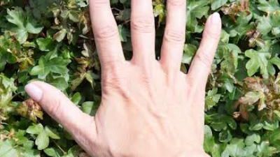 Dissociatieve identiteitsstoornis (DIS)