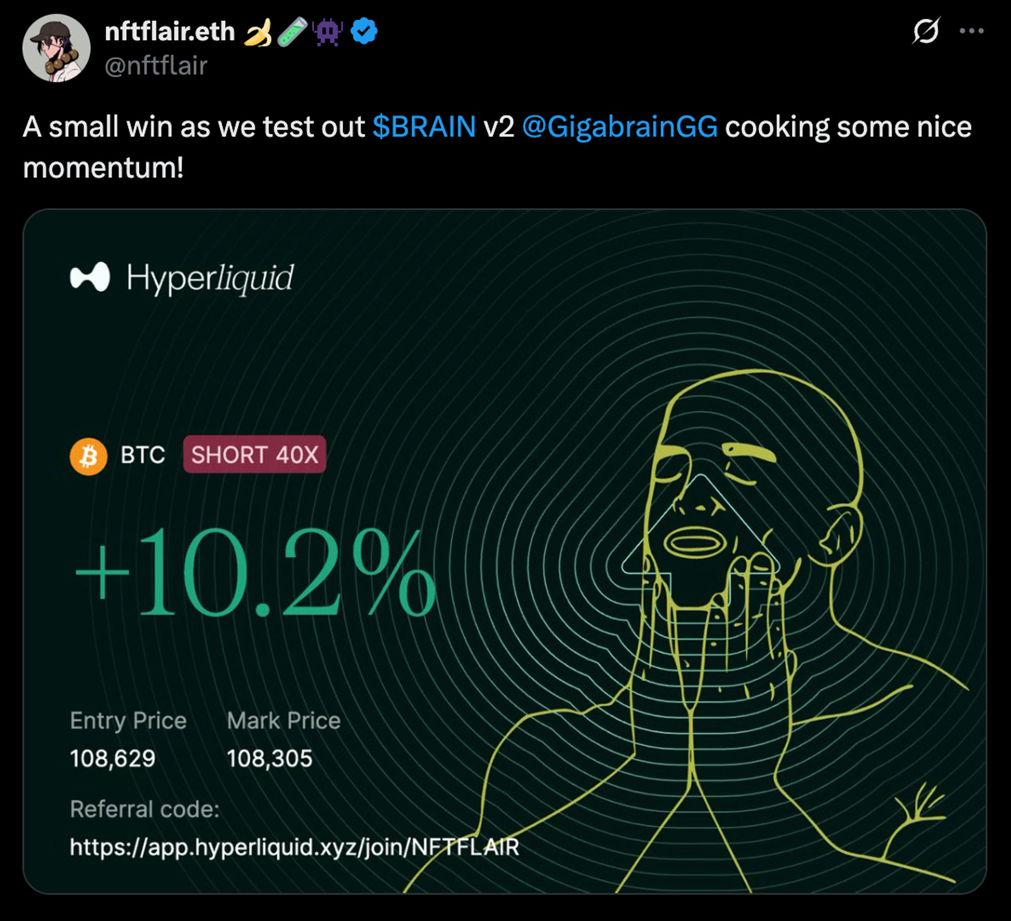 Gigabrain