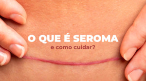 Seroma: o que é e como cuidar? - Dr. Daniel Rufatto