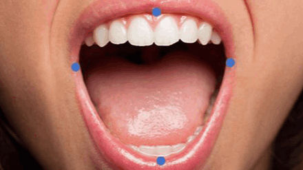 Landmark Annotation | Keypoint Annotation - Precise BPO Solution