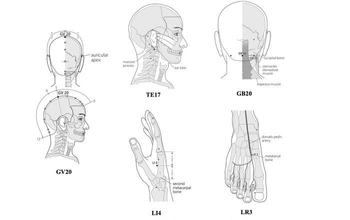 Gambar Titik Akupuntur Untuk Vertigo Beserta Prosedurnya - Efje Klinik