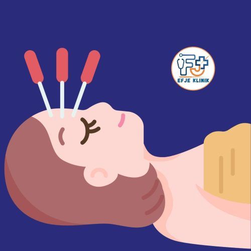Klinik Akupuntur Jakarta dr. Freddy Julianto | Akupuntur Terjangkau Bekasi