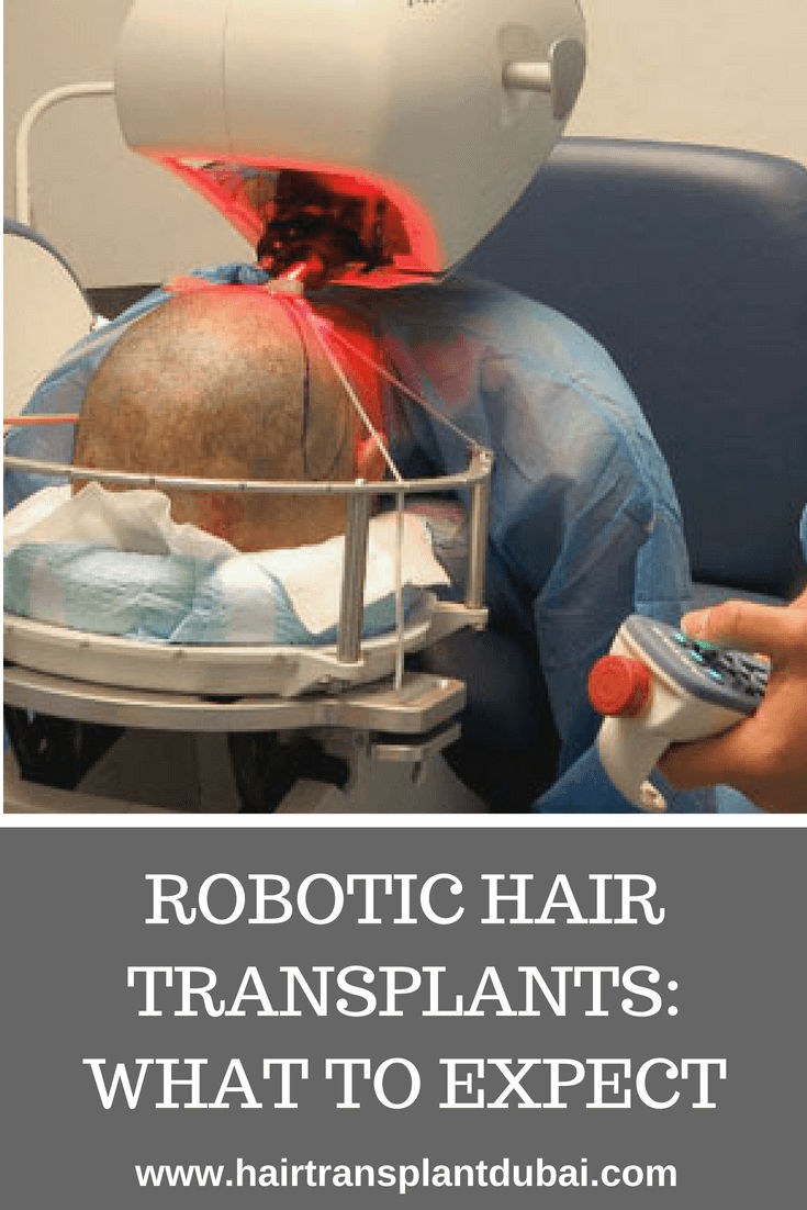 Robotic Hair Transplants: What to Expect | Hair Transplant Dubai