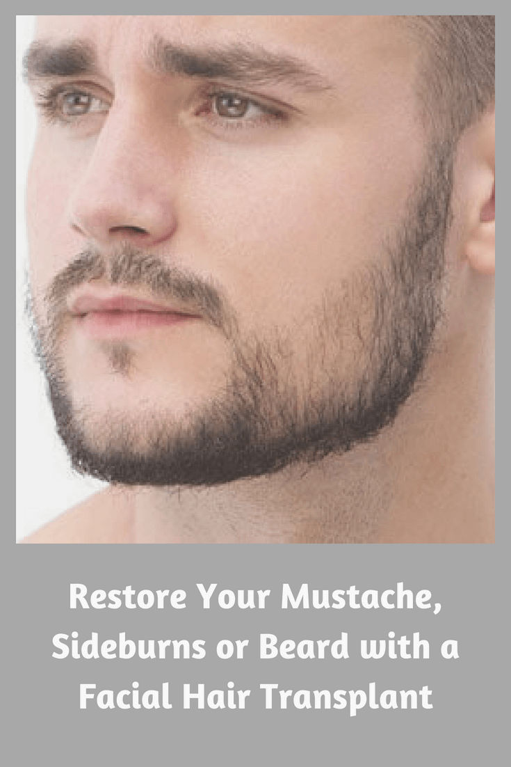 Restore Your Mustache, Sideburns or Beard with a Facial Hair Transplant ...