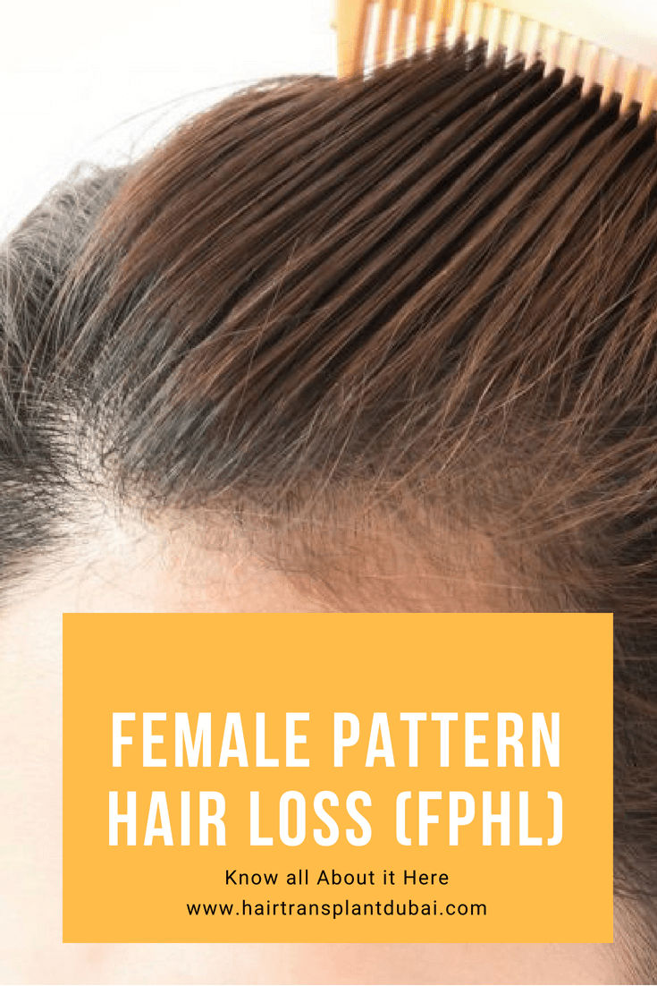 Female pattern hair loss (FPHL) | Hair Transplant Dubai
