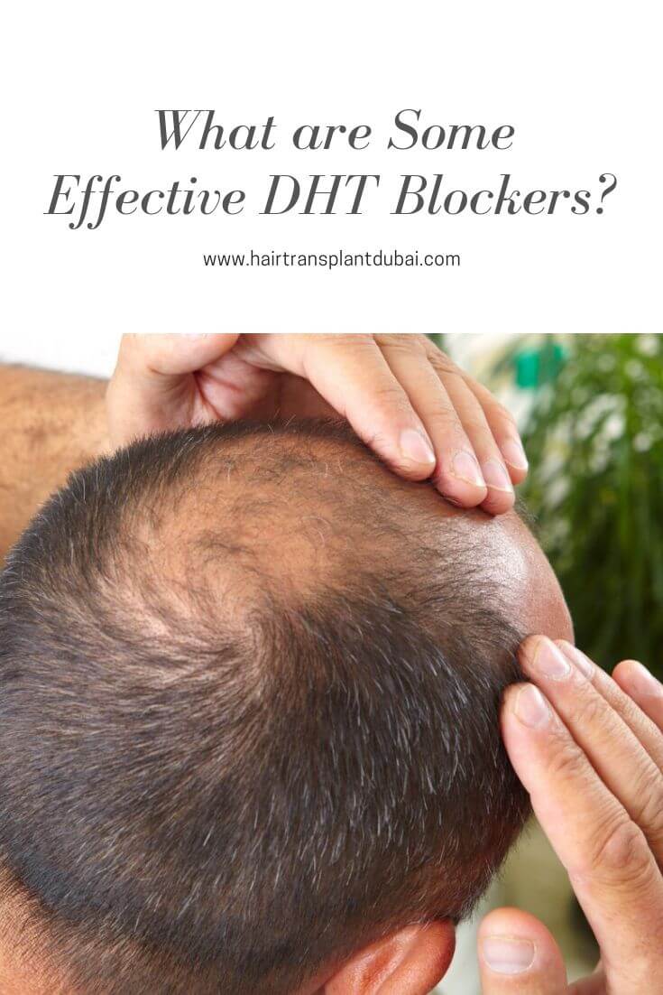 What are Some Effective DHT Blockers? | Hair Transplant Dubai