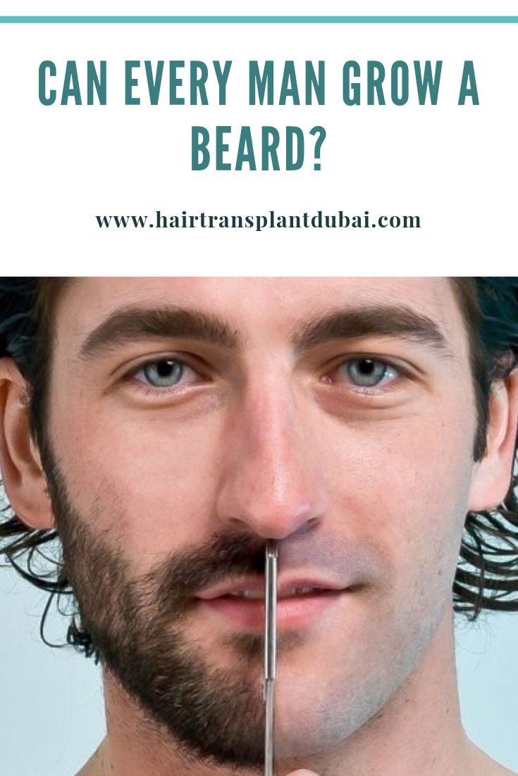 Can Every Man Grow a Beard? | Hair Transplant Dubai