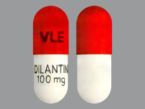 Dilantin: Uses, Prices, Dosage, Side Effects & More
