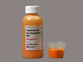What does Cephalexin look like?