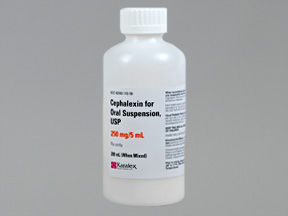 What does Cephalexin look like?