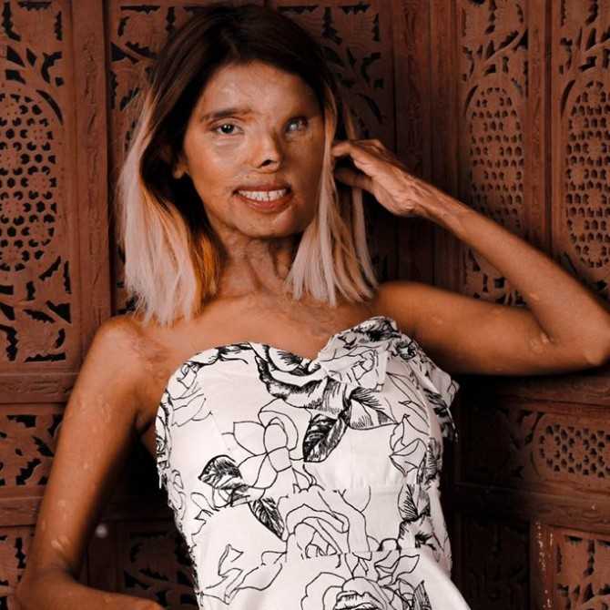 Anmol Rodriguez TEDx Speaker Influencer Model Age Instagram